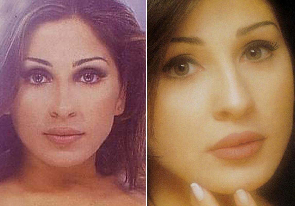 صور اليسا قبل وبعد مراحل تطوّر جمالها عبر السنوات جمالك